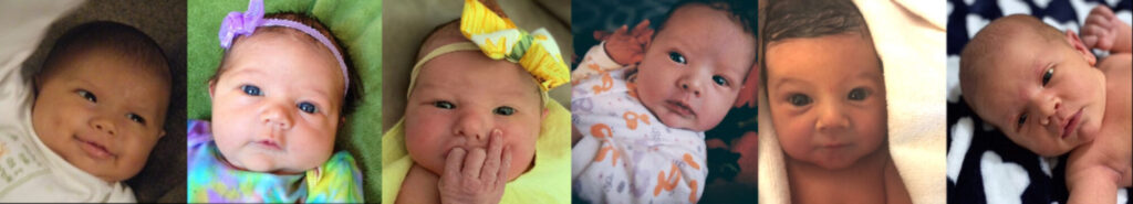 Posterior Presentation | Home4Birth